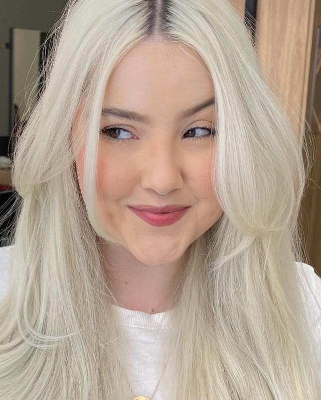 Monique Lindmann: “Demorei dois meses até expor que tive um corte ...