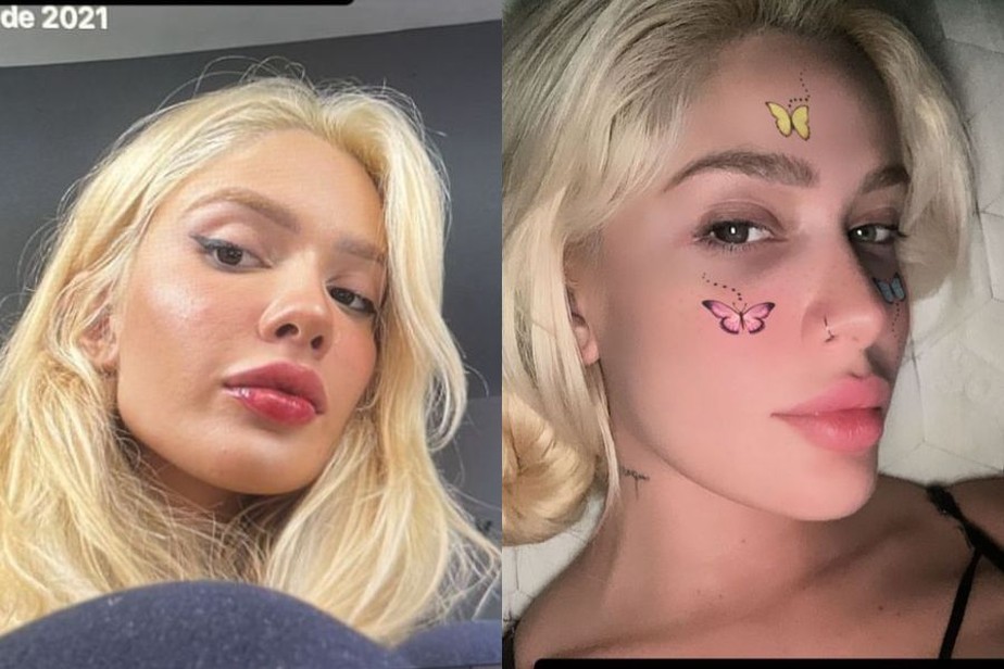 Karoline Lima diz ter removido harmonização facial e mostra antes e depois