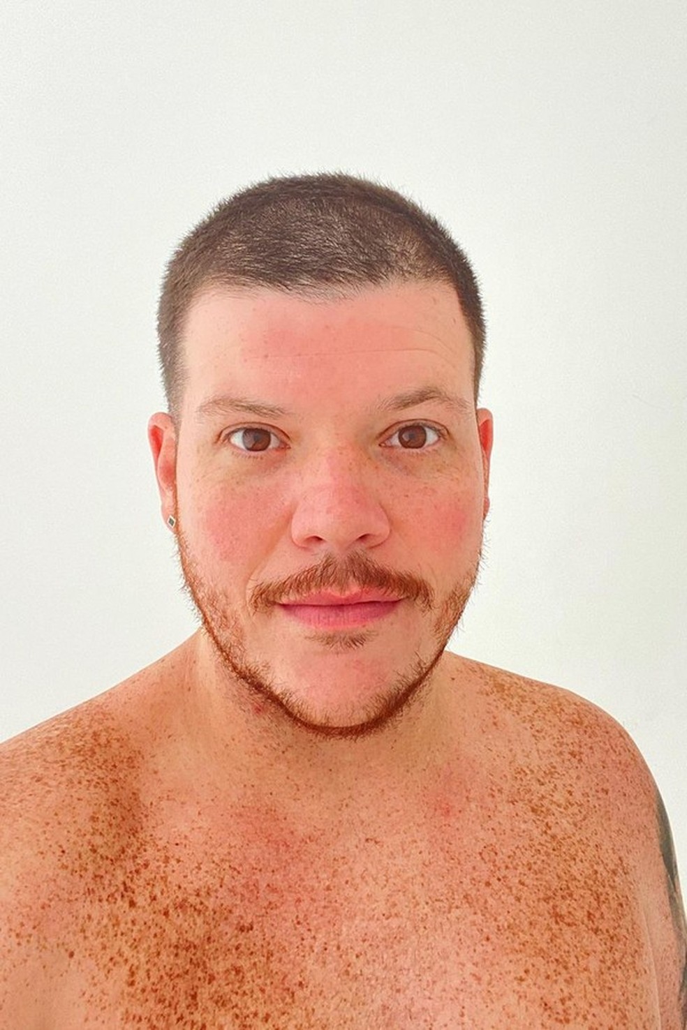 Ferrugem posta selfie, mostra sardas e fala de apelido