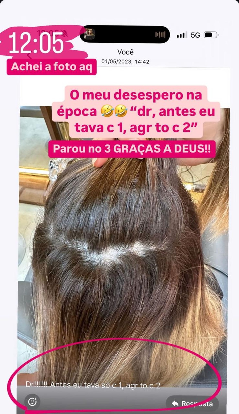 Virginia comemora crescimento do cabelo após ter alopecia: 'Não é corte ...