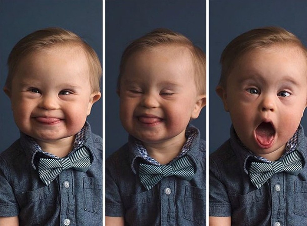 Bebê com síndrome de Down é rejeitado por agência e inspira campanha