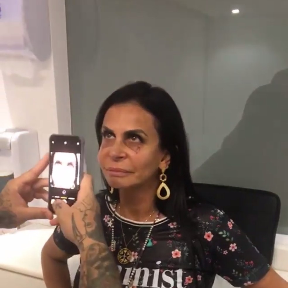 Gretchen aposta em tatuagem para esconder olheiras