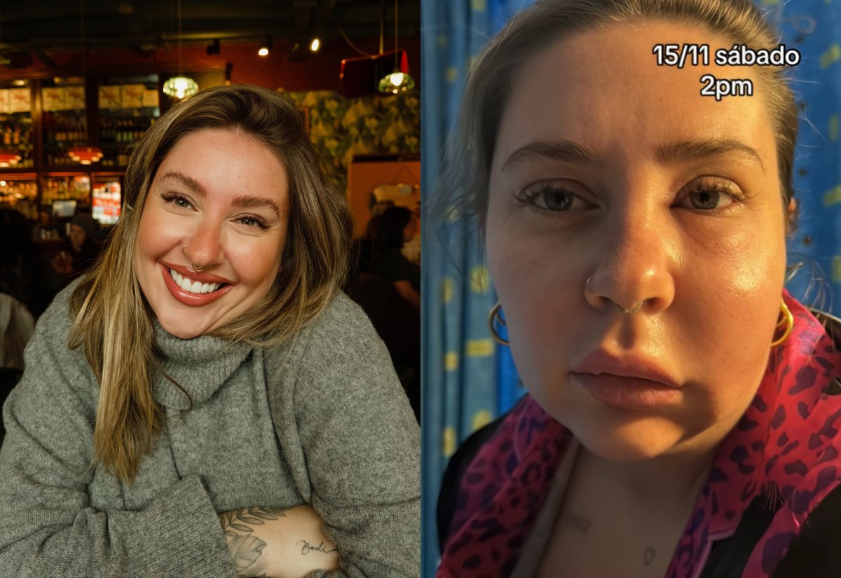 Após limpeza dental na Irlanda, brasileira contrai bactéria e faz ...