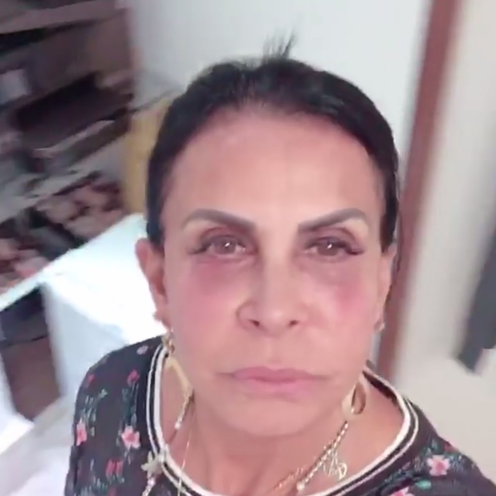 Gretchen aposta em tatuagem para esconder olheiras