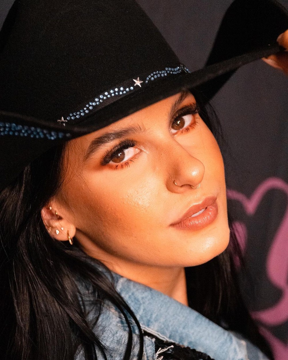 Ana Castela mostra resultado de rinomodelação; confira antes e depois