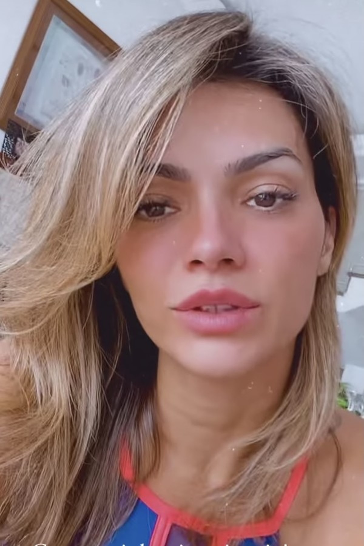 Kelly Key precisará passar por cirurgia