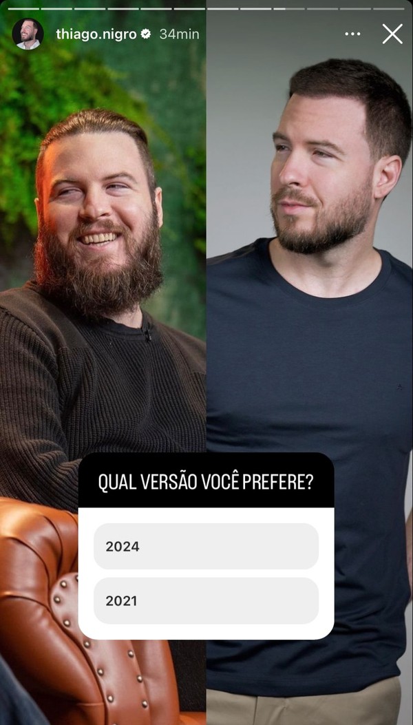 Thiago Nigro mostra antes e depois e reflete sobre mudança de estilo