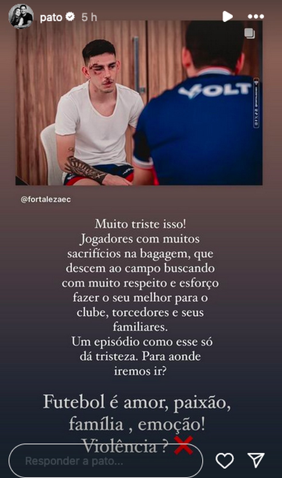 Pato comenta ataques a jogadores do Fortaleza: 'Muito triste, futebol é ...