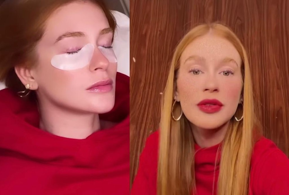 Marina Ruy Barbosa mostra antes e depois de procedimento estético