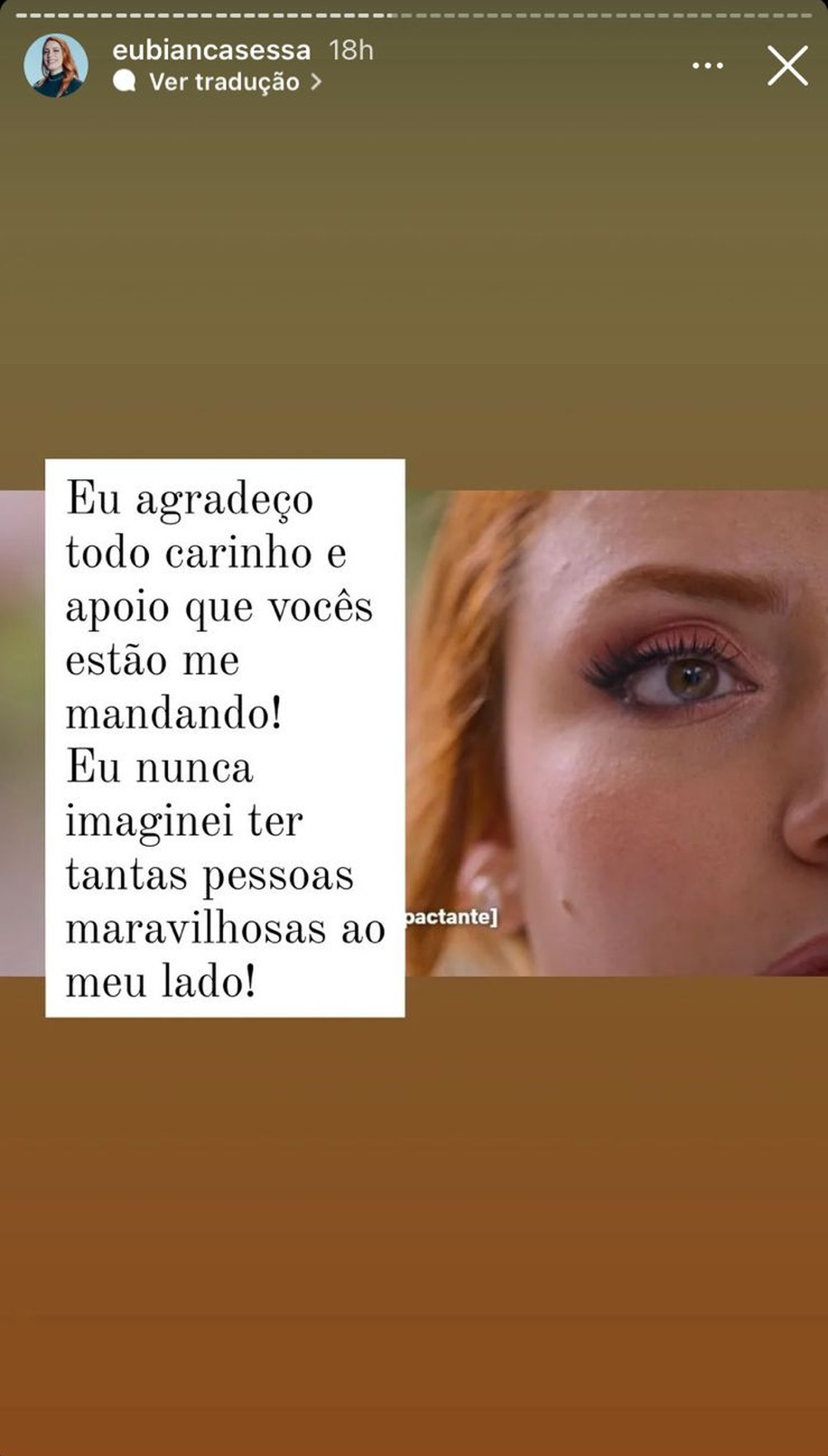 Bianca Sessa é vítima de piada capacitista e alerta humorista ...