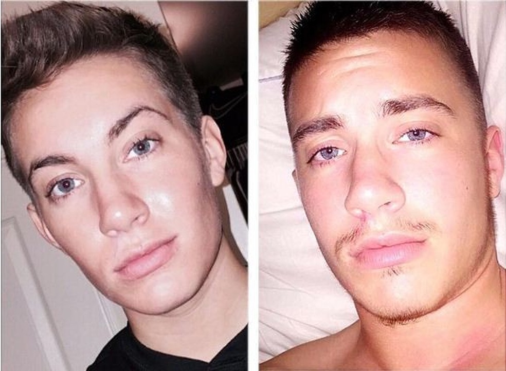 Homem transgênero faz antes e depois no Instagram para conscientizar ...