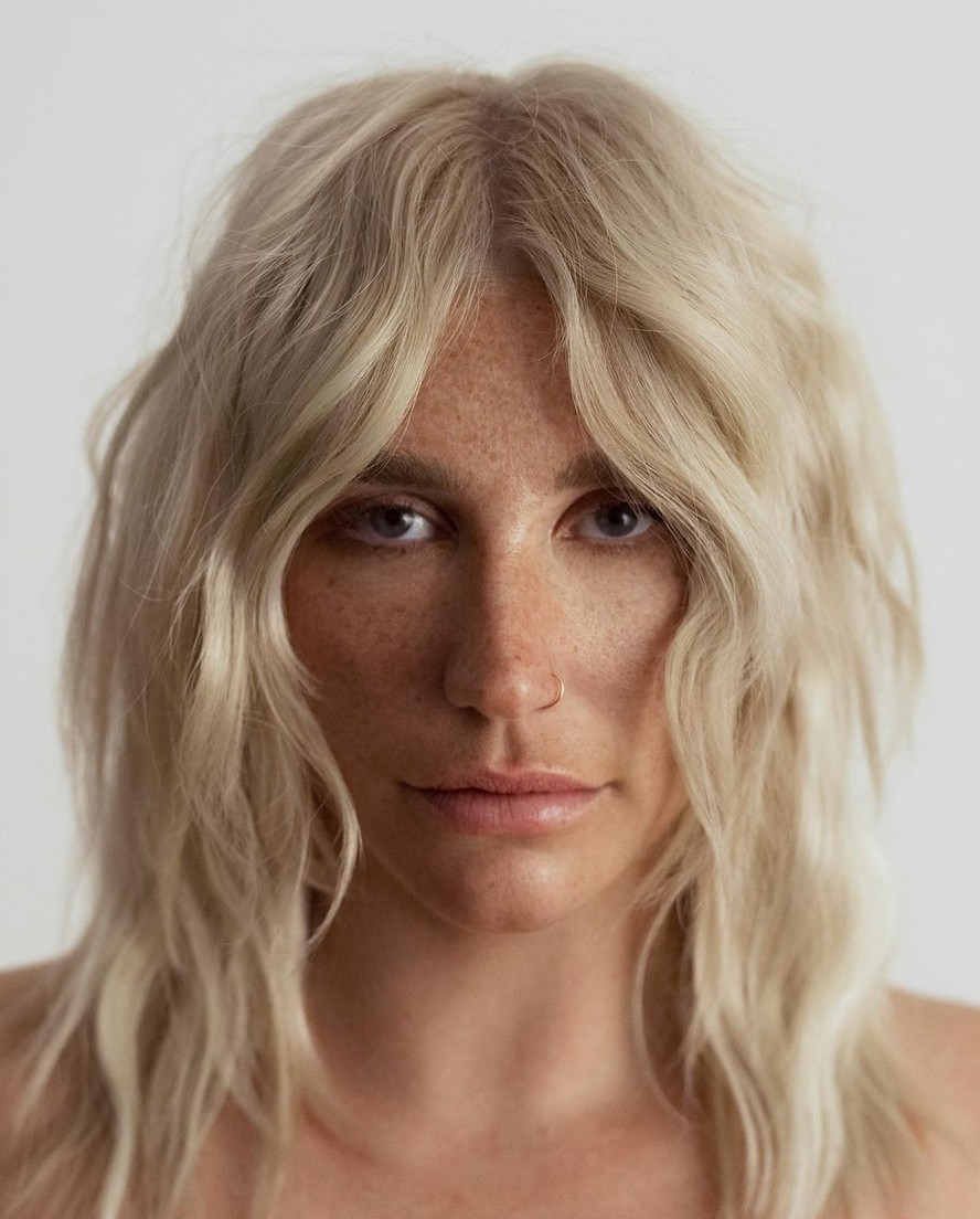 Kesha diz que quase morreu de uma complicação rara decorrente de um ...