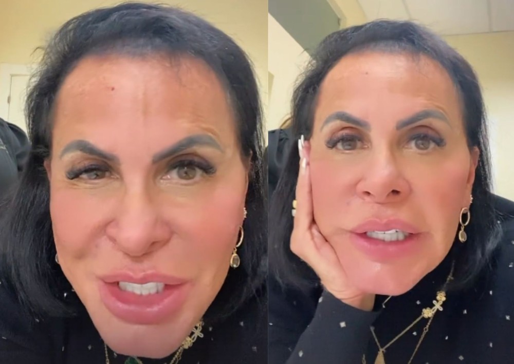Gretchen mostra antes e depois de tratamento contra alopecia; resultado ...
