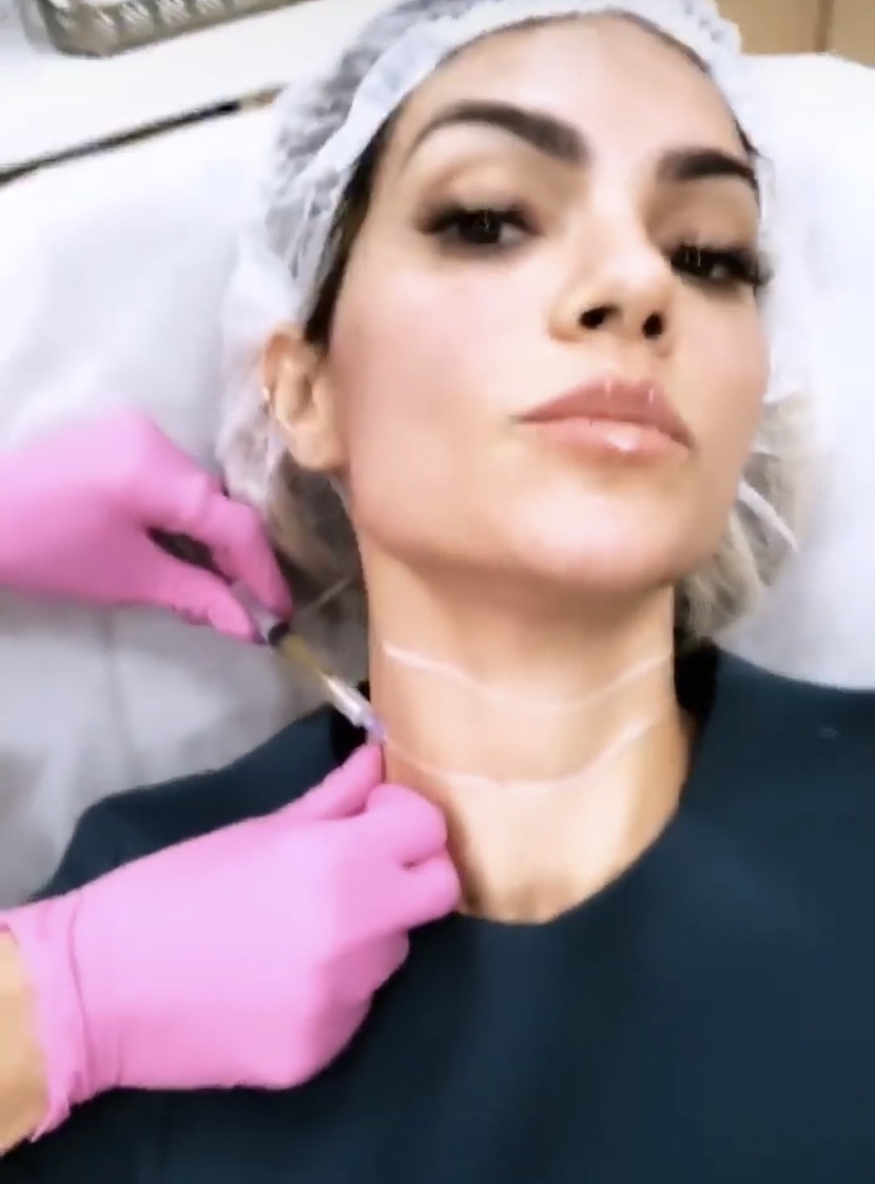 Kelly Key choca ao mostrar procedimentos estéticos