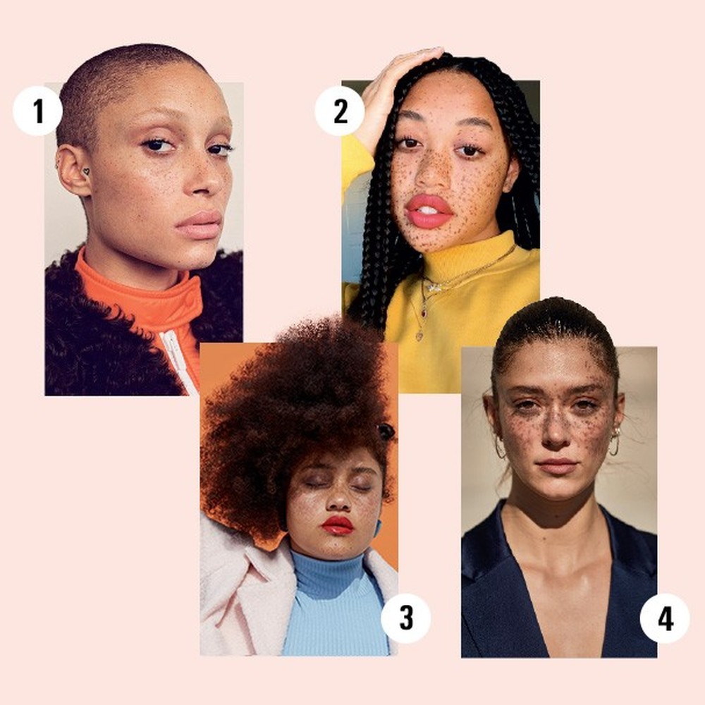 Dossiê das sardas: como cuidar, valorizar e arrasar com as suas pintinhas