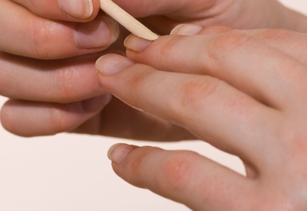 Problema de beleza se resolve em casa: confira soluções caseiras