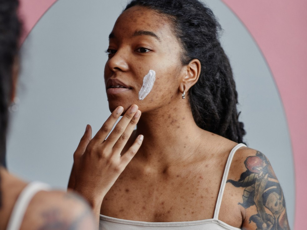 Tipos de acne: conheça os 4 graus e saiba como cuidar