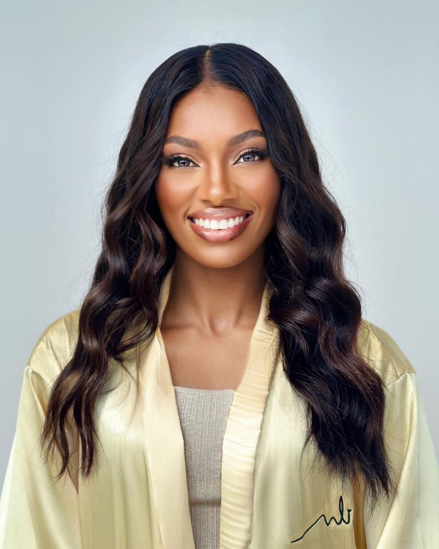 Tina Calamba, do BBB23, relata danos nos olhos após uso de pomada capilar