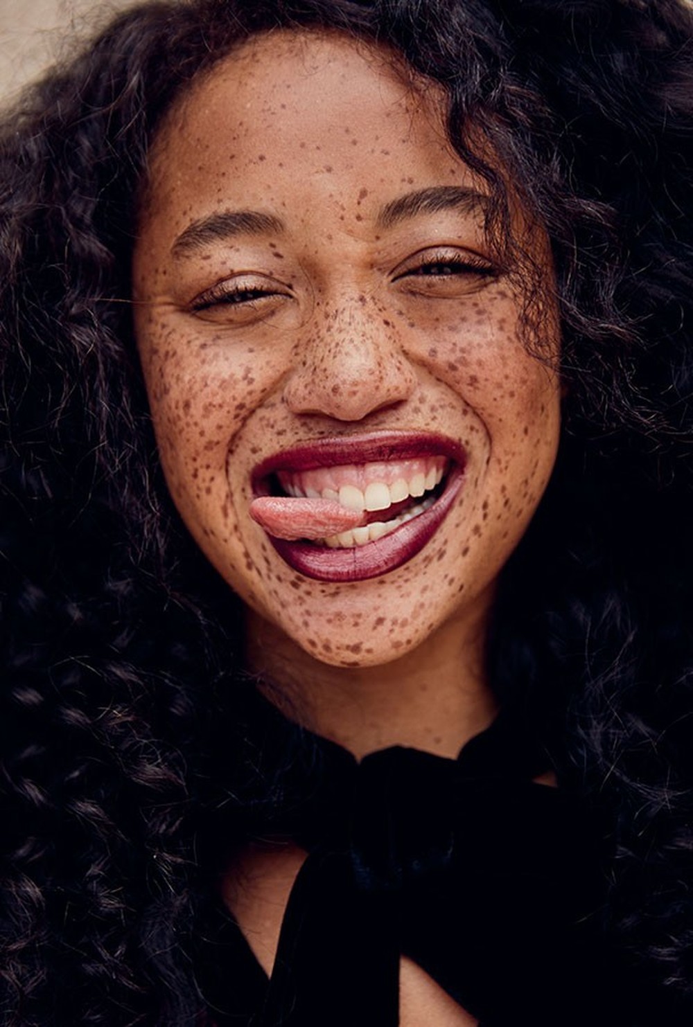 Dossiê das sardas: como cuidar, valorizar e arrasar com as suas pintinhas