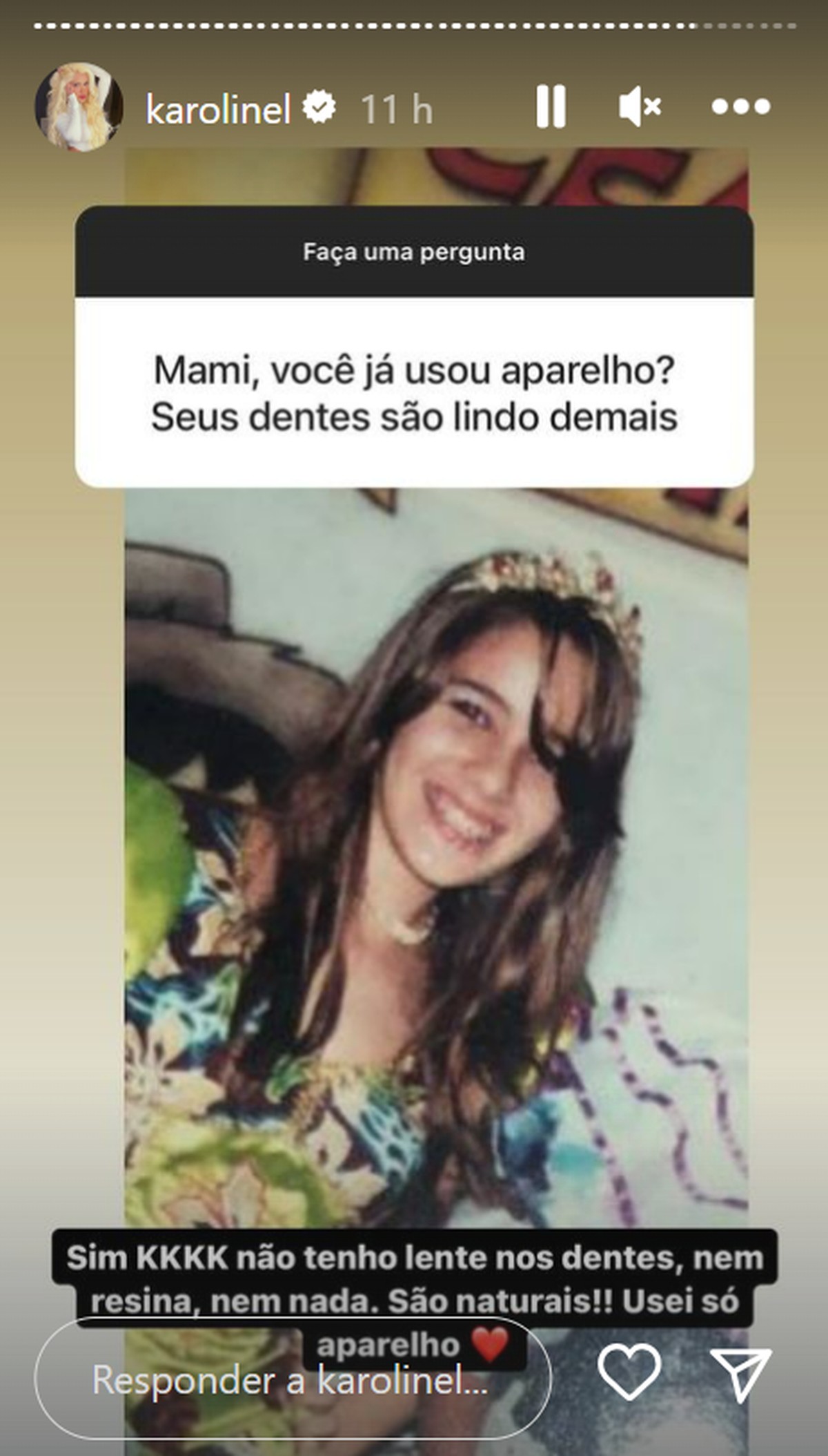 Karoline Lima surpreende fãs com clique antes de ser famosa