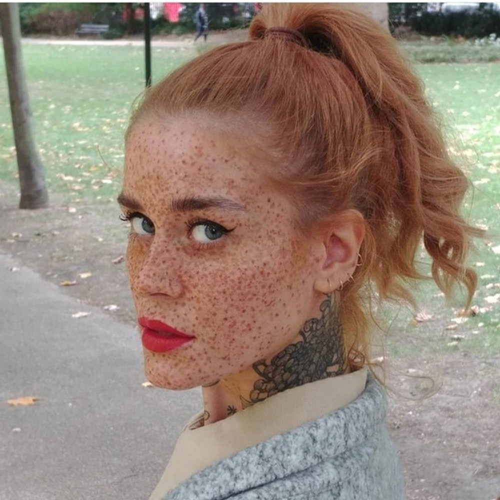 Sardas: o que são e como 6 garotas bombam ao exibirem com orgulho as ...