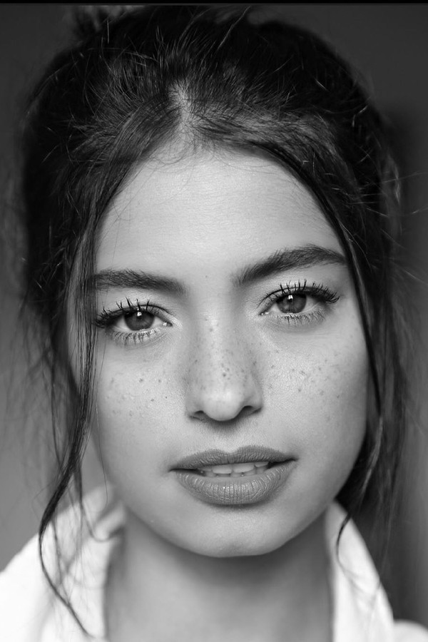 Cynthia Senek exibe sardas e conta: 'Eu odiava'