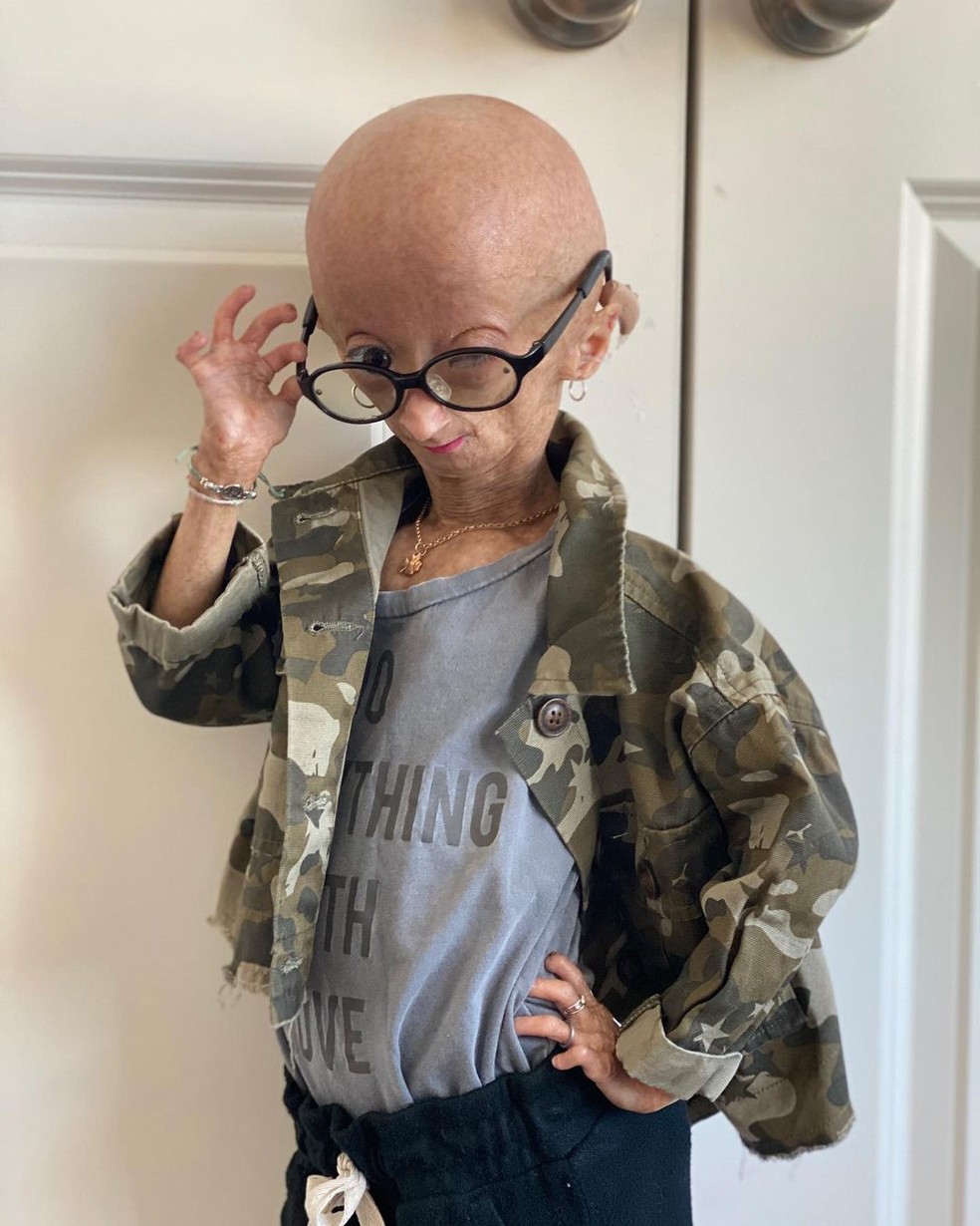 Morre Adalia Rose Williams aos 15 anos