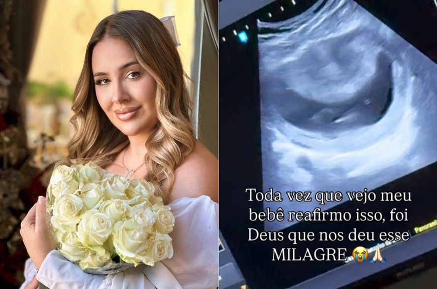 Grávida após aborto espontâneo, ex-BBB Patrícia Leitte mostra ultrassom ...